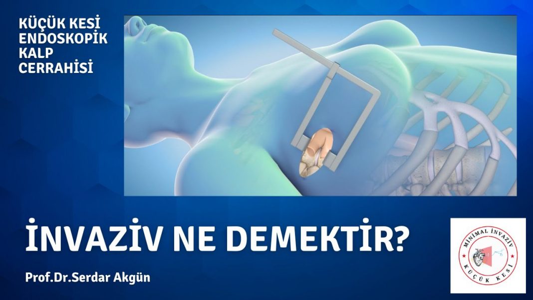 Minimal İnvaziv Küçük Kesi Endoskopik Kalp Ameliyatı | Prof.Dr. Serdar ...